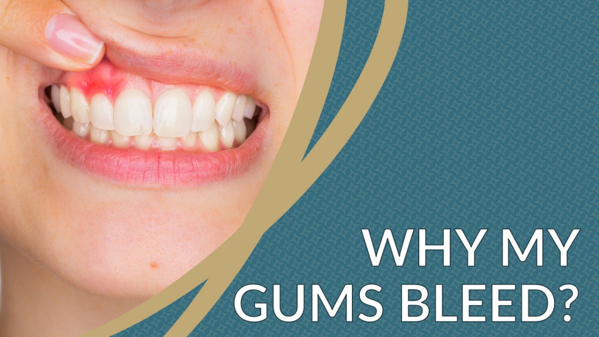 My Teeth Do Not Hurt So Why Should I Go To The Dentist? - Marquez ...